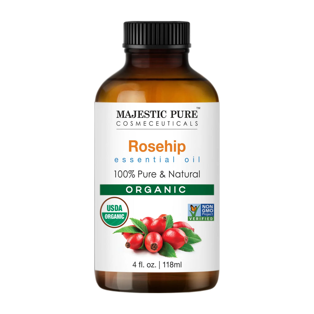 100% Pure Rosehip Essential Oil | Majestic Pure – Majestic Pure ...
